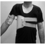 SGEM#121: Internal or External Shoulder Immobilization (It Don’t Matter ...